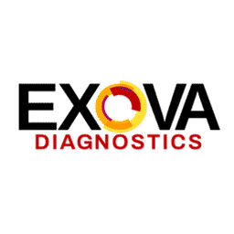 Exova Diagnostics - Crunchbase Company Profile & Funding